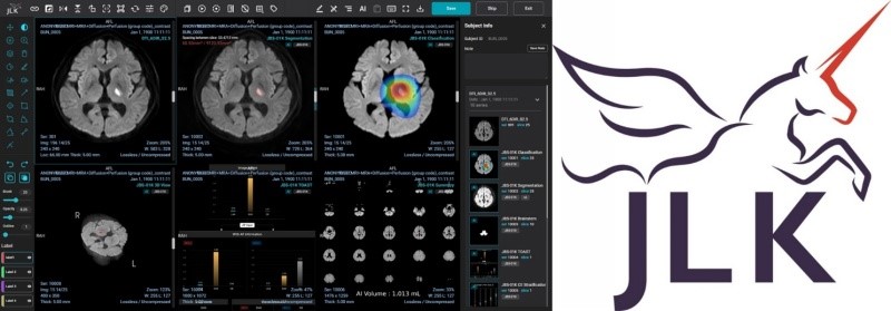 JLK Unveils Its AI-Powered Imaging Diagnosis Solutions for Stroke | Markets Insider