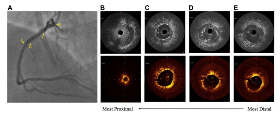 Novasight™ Hybrid Imaging System Featured in Published